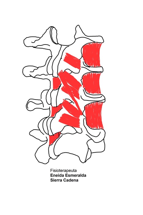 Multifidos. Estabilizadores de la Columna :: alternativasenfisioterapia