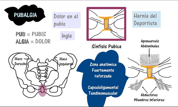 pubalgia